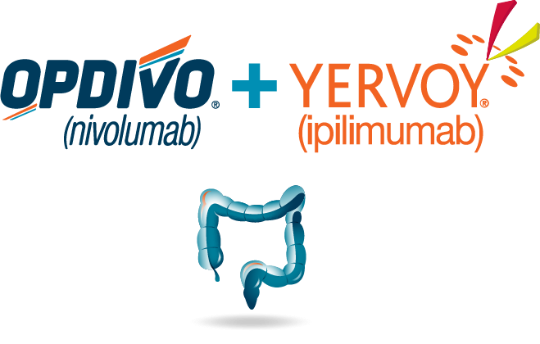 Efficacy in Colorectal Cancer (CRC) | OPDIVO® (nivolumab) + YERVOY® (ipilimumab)